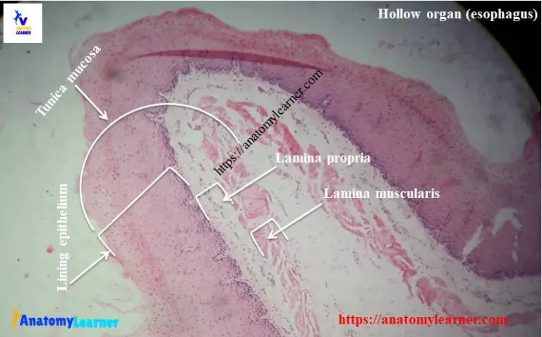 Hollow Organ Histology - General Organizational Pattern for Any Tubular ...