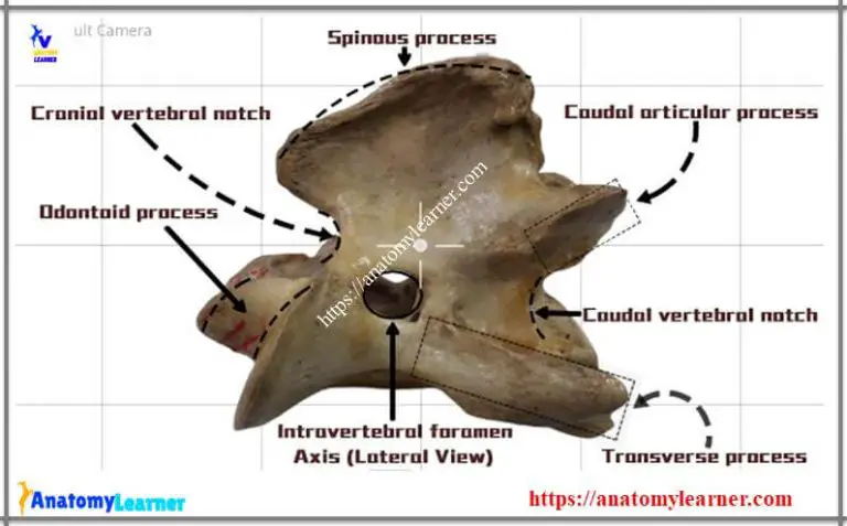 Animal Vertebrae Identification - Anatomy of Cervical, Thoracic and ...
