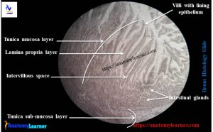 Ileum Histology Slide with Labeled Diagram and Identification Points ...