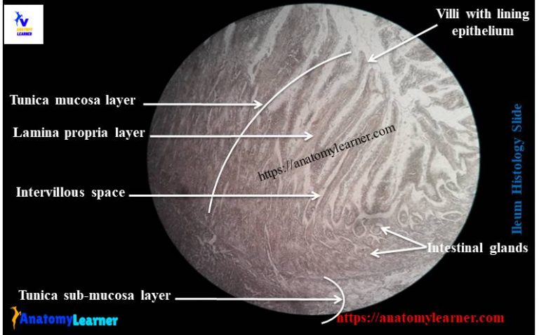 Ileum Histology Slide with Labeled Diagram and Identification Points ...