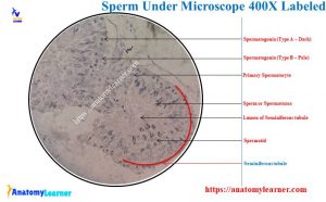 Sperm Under Microscope with Labeled Diagram » AnatomyLearner ...