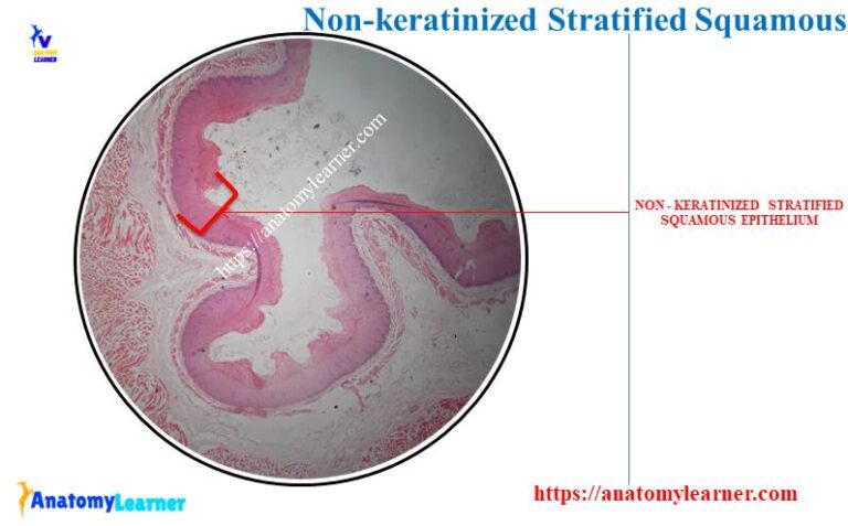Stratified Squamous Epithelium Under Microscope with Labeled Diagram ...